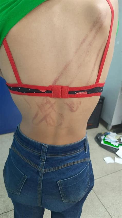 Pai E Madrasta S O Presos Por Tortura Contra Adolescente Em Bh O Tempo