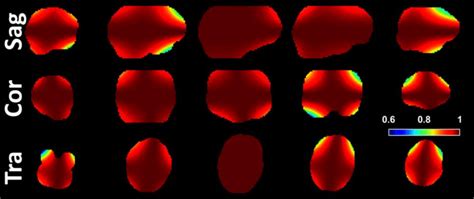 when the waveforms are maxwell compensated by k nulling using a slice download scientific