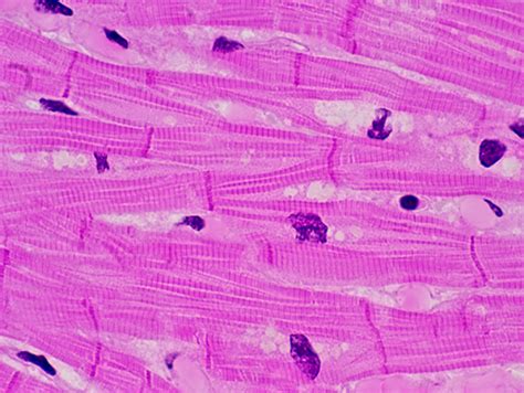 Tbx Enhances Reprogramming Of Heart Fibroblasts Into Heart Muscle