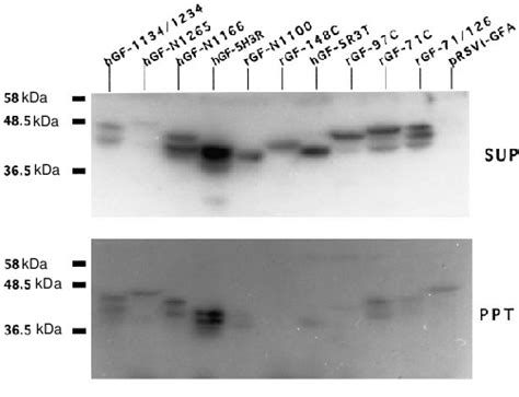 Western Blot Analysis Of The Deletion Mutants Of GFAP From Whole Cell