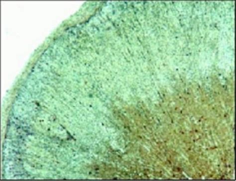 Etx Adrenal Ch Fig Endotext