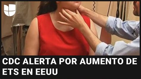 CDC alertan por aumento de infecciones de transmisión sexual en EEUU