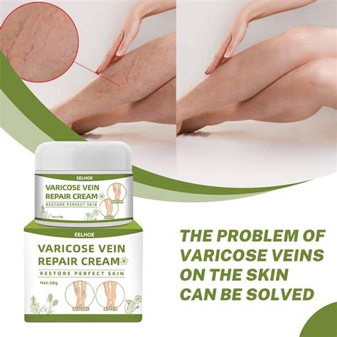 50g Krampfadern Creme Varicose Veins Creme Kaufland De