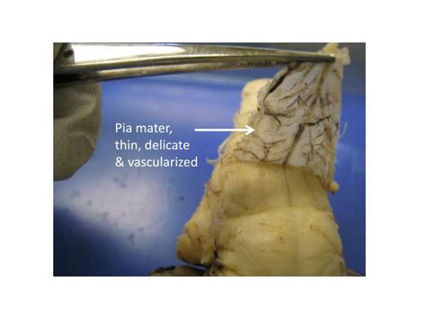 PPT Lab 12 Sheep Brain Dissection PowerPoint Presentation ID 2162022