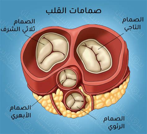 عملية إصلاح الصمام التاجي في تركيا بيمارستان