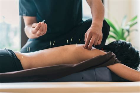 Agopuntura che cosè a cosa serve benefici come funziona