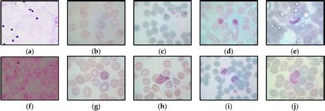 Diagnostics Free Full Text Robust Image Processing Framework For