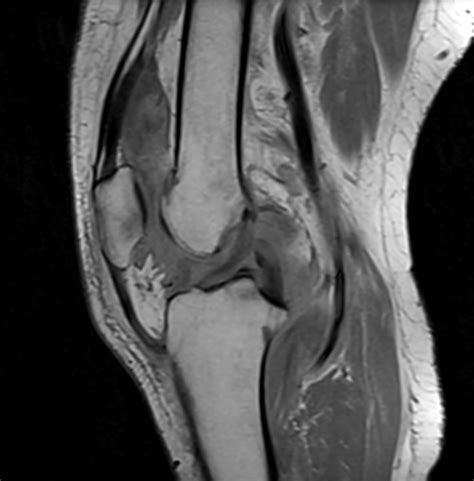 Image Radiopaedia Org