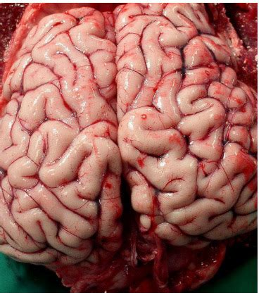 Brain Regions And Functions Flashcards Quizlet