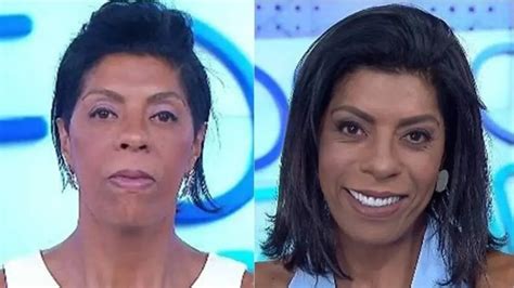 M Rcia Fu Revela Transforma O Ap S Harmoniza O Facial E Surpreende F S