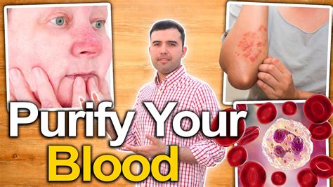 How To Purify Your Blood Naturally YouTube