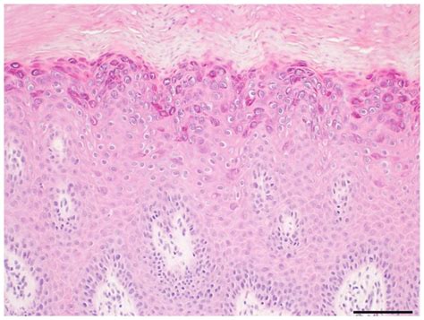 Hematoxylin and eosin staining scale bar 100 µm Download