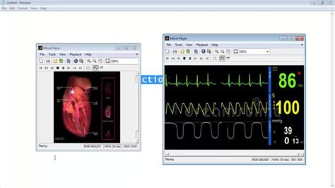 ecg signal processing matlab code projects youtube