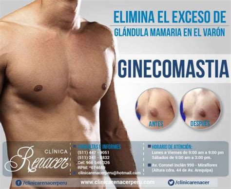 Clínica renacer ginecomastia en Lima Otros Servicios 578168