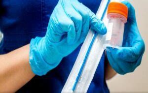 Cuál es la diferencia entre el test de cobas y el Papanicolaou para