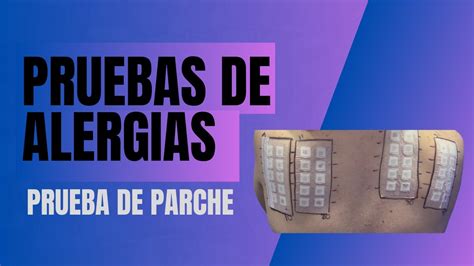 Prueba De Parche O Prueba Epicutanea De Alergias YouTube