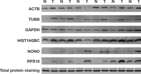 Western Blot Quantification Using Imagej Difity