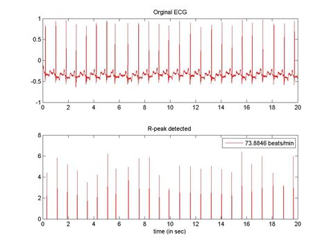 github prateekrajgautam ecg wavelet feature extraction ecg wavelet feature extraction