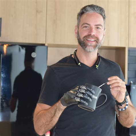 Moises 3 prothèses de main une histoire Naked Prosthetics