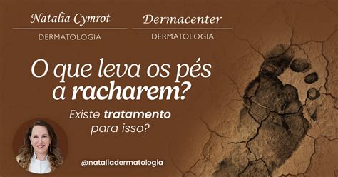 O que leva os pés a racharem Existe tratamento para isso Clínica