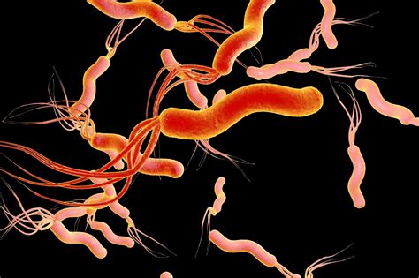 Refractory Helicobacter Pylori Infection An AGA Clinical Practice