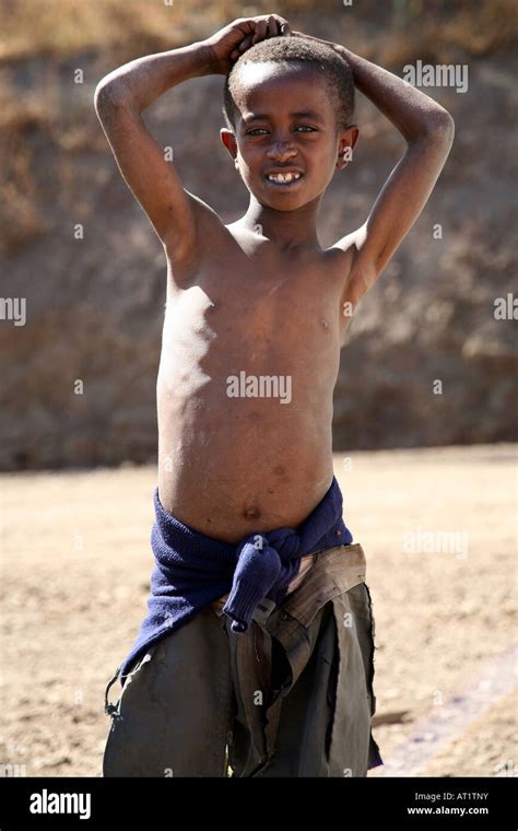 Enfant Maigre Afrique Banque De Photographies Et Dimages Haute