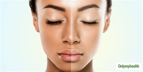 Skin Whitening Tips With Olive Oil Shop Ruthiesnotions