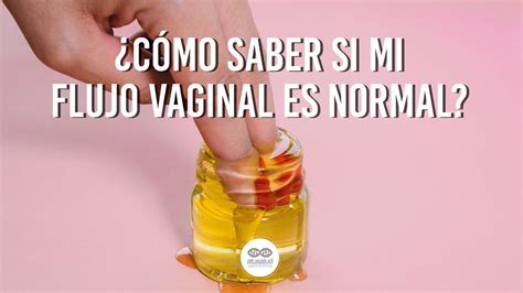 C Mo Saber Cu Ndo El Flujo Vaginal Es Normal O Anormal Consulta