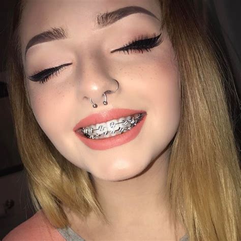 Pin On Braquets
