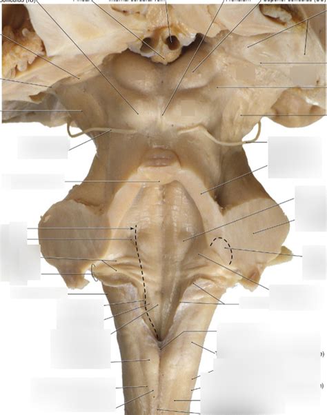 Ventral Brainstem Diagram Quizlet