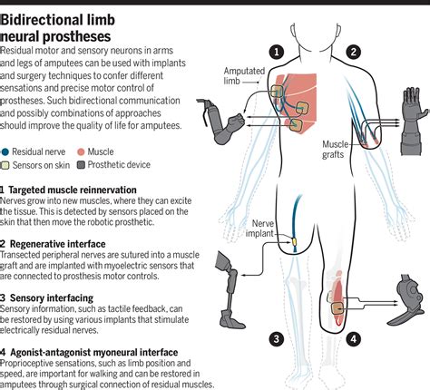 advancing limb neural prostheses science