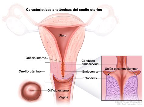 Definición de exocérvix Diccionario de cáncer del NCI NCI