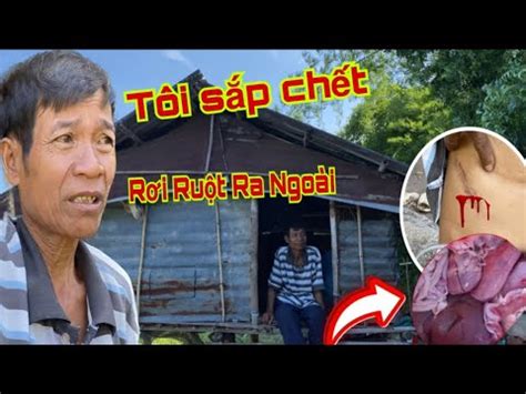 Kỳ Tích Người Đàn Ông Kể Lại Giây Phút KINH HOÀNG Bị LÒI RUỘT Chỉ Vì Lý