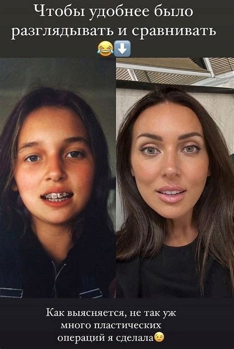 Алсу решила всем показать что не так много пластики она сделала а ведь и правда Дизайн