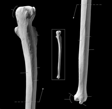 Ulna Definition Location Anatomy Functions Diagram