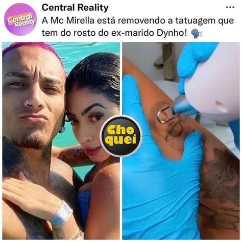 Central Reality A Mc Mirella está removendo a tatuagem que tem do rosto