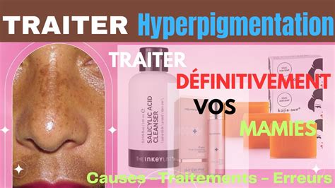 Comment traiter et faire disparaître définitivement lhyperpigmentation