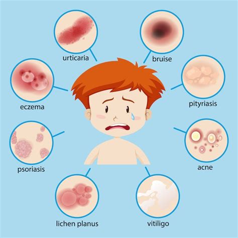 Diagrama que muestra al niño con diferentes afecciones de la piel