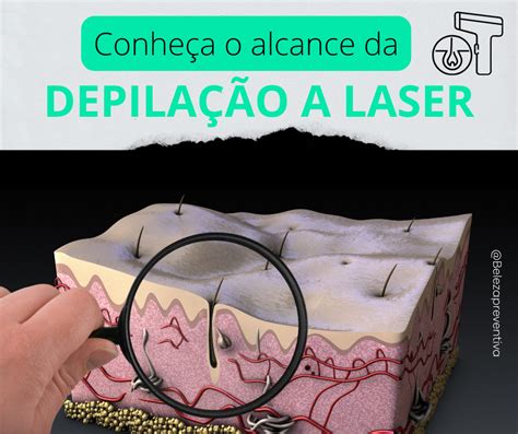 Depilação a Laser no Rosto belezapreventiva br
