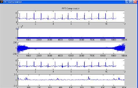 figure 4 from design and analysis of an efficient technique for compression of ecg signal