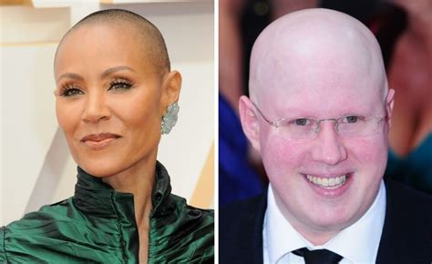 12 Celebrities With Alopecia Hair Loss Wimpole Clinic