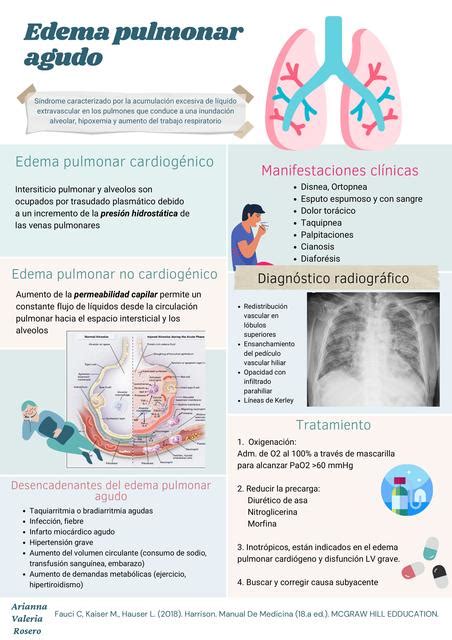 Edema Agudo de Pulmón Valeria Rosero uDocz