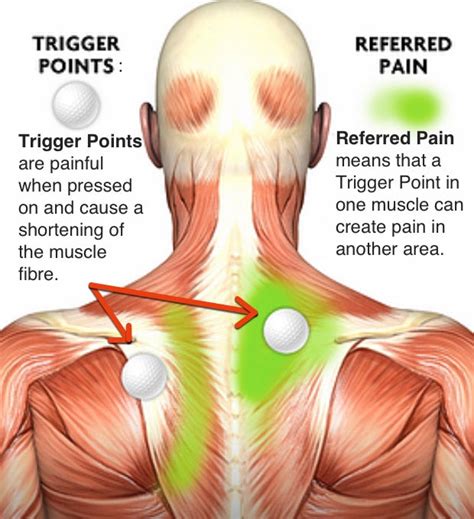 Is That Knot In Your Neck Really A Knotted Muscle EnVy Pillow Canada