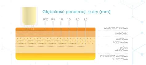 Metody Mezoterapii Ig Owej Pimik Wroc Aw