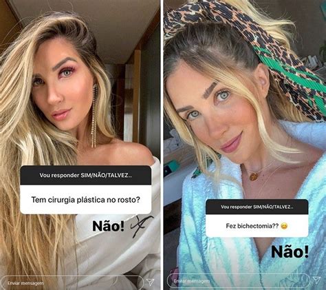 Ex BBB Aline Gotschalg responde fãs e nega plásticas no rosto