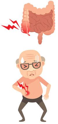 Apendicitis aguda en qué consiste esta patología