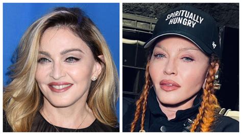 Madonna admite sus últimas operaciones estéticas los retoques que se