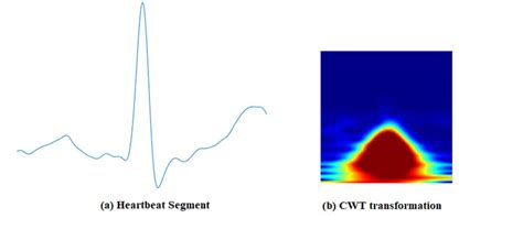 continuous wavelet transformation a a segment of ecg signal b cwt download scientific