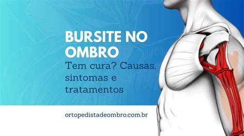 Bursite No Ombro Tem Cura Conhe A As Causas Sintomas E Tratamentos