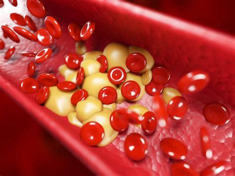 Hdl Is Not Always Good Cholesterol During Menopause Transition